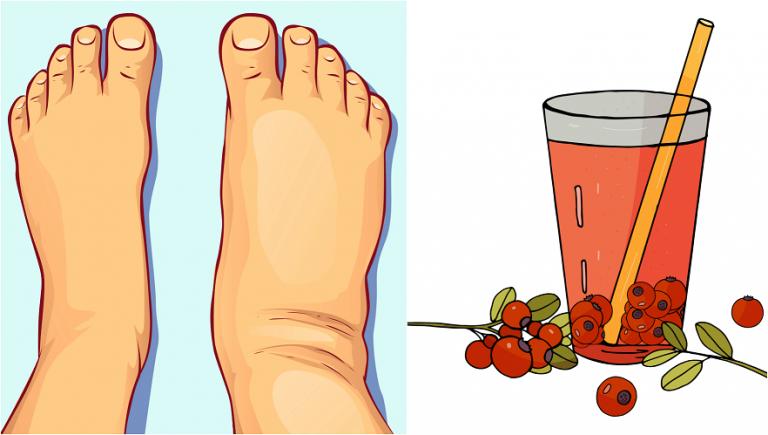 11 Home Remedies to Reduce Water Retention - Crafty Morning